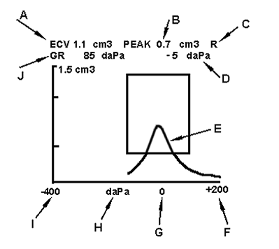 Tympanometry – Department of Pediatrics – UW–Madison